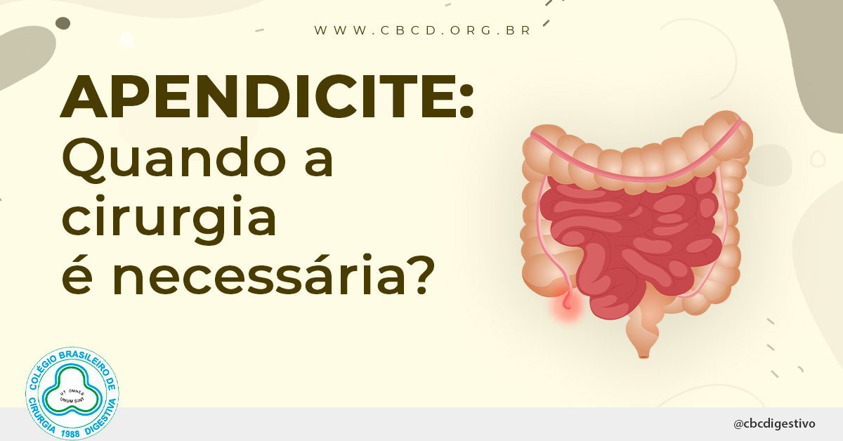 Apendicectomia Aberta APENDICECTOMIA ABERTA E VIDEOLAPAROSCÓPICA NO