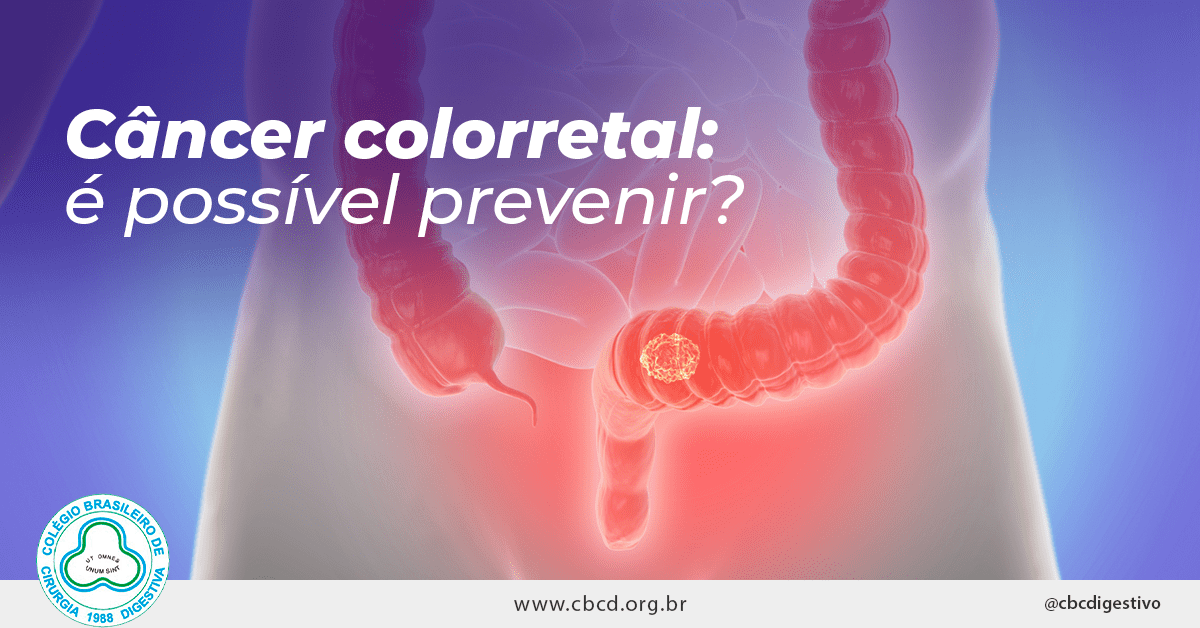 Câncer colorretal: é possível prevenir? – CBCD