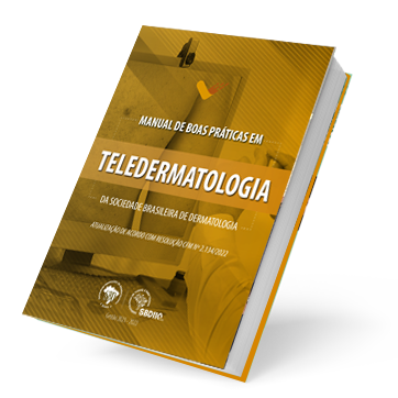 SBD publica guia atualizado de Teledermatologia - SBD