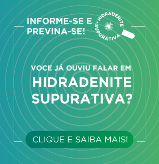 Hidradenite Supurativa - SBD
